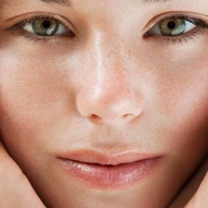 Large Pores Treatment in Islamabad, Rawalpindi & Pakistan | Open Pores